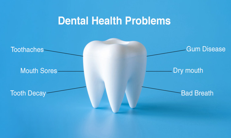 7 Common Dental Problems and Tooth Diseases